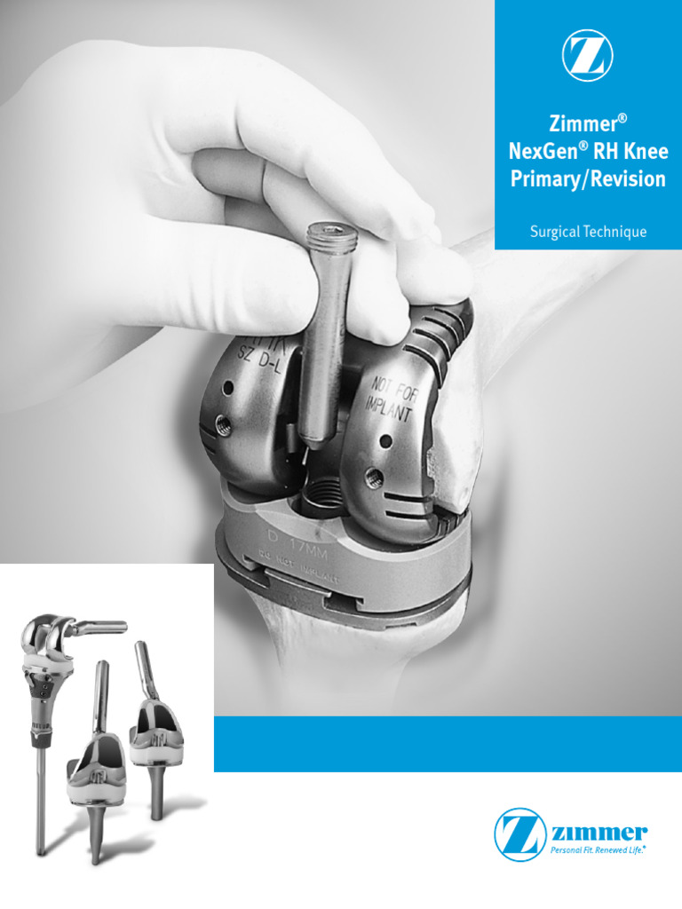Zimmer Nexgen RH Knee Primary Revision Technique | PDF | Knee ...