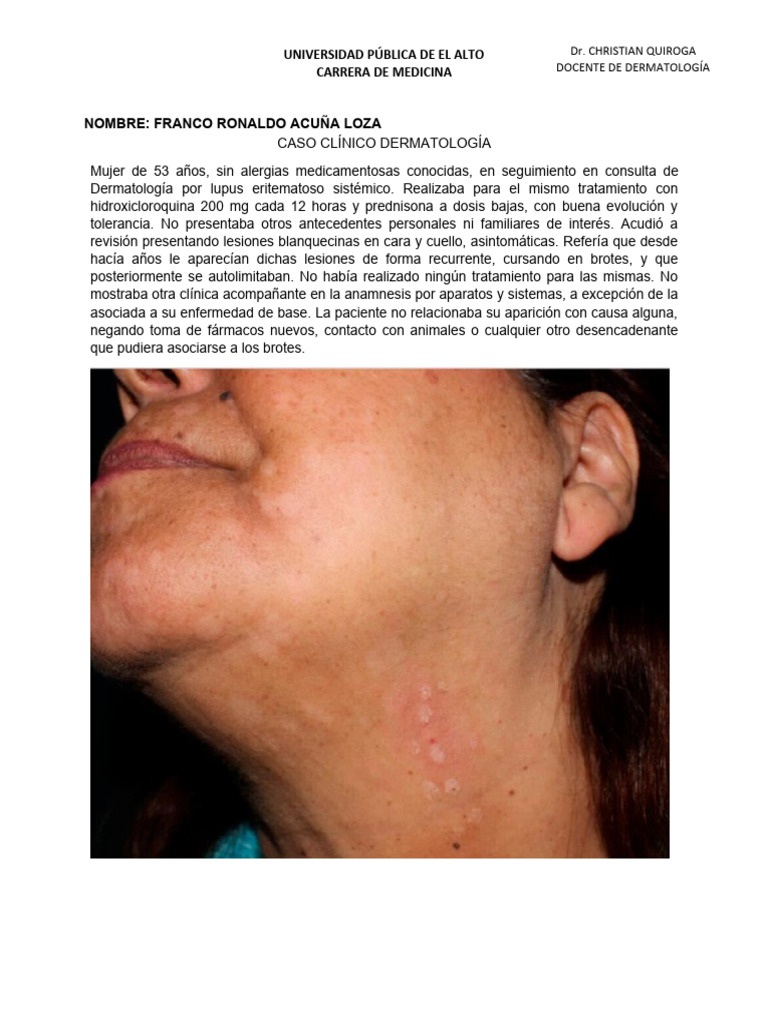 Caso Clínico Dermatología - 095942 | PDF | Sistema inmune | Epidemiología