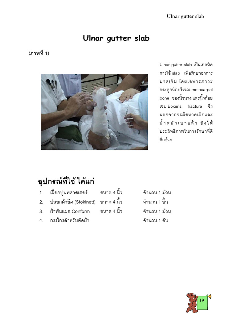 Ulnar Gutter | PDF