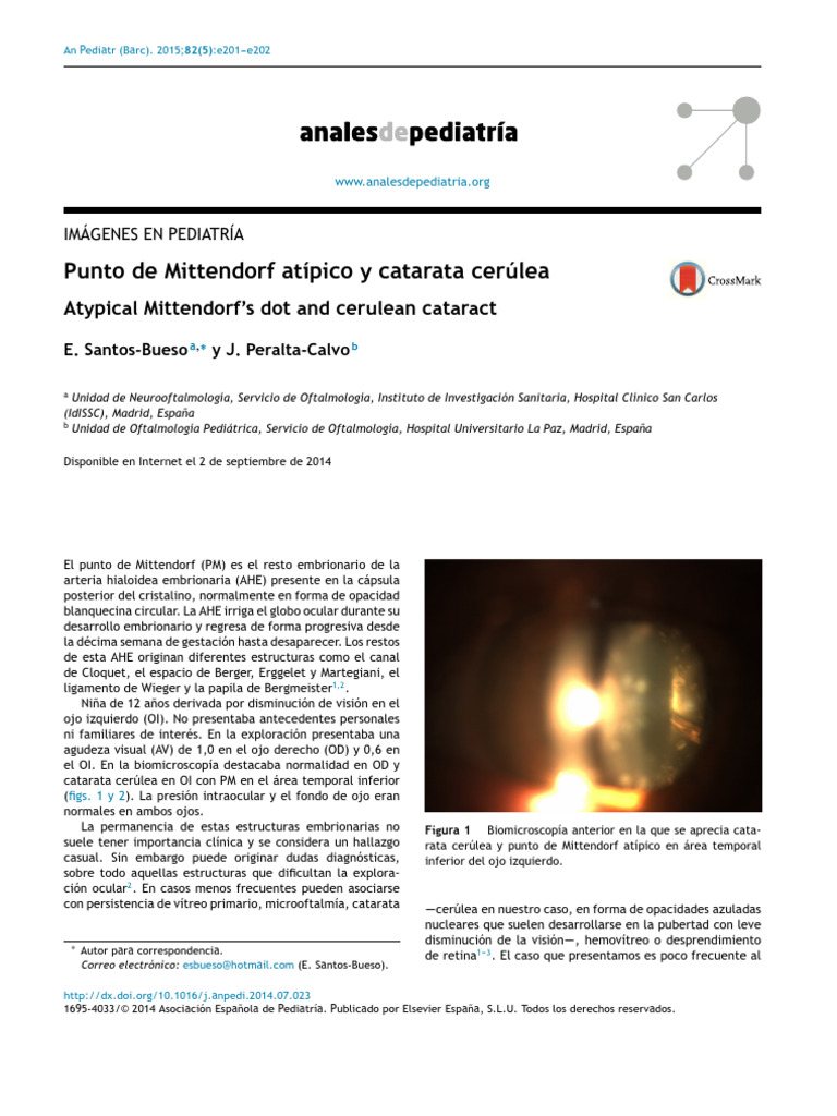 Punto de Mittendorf y catarata cerúlea | PDF | Oftalmología | Ojo humano