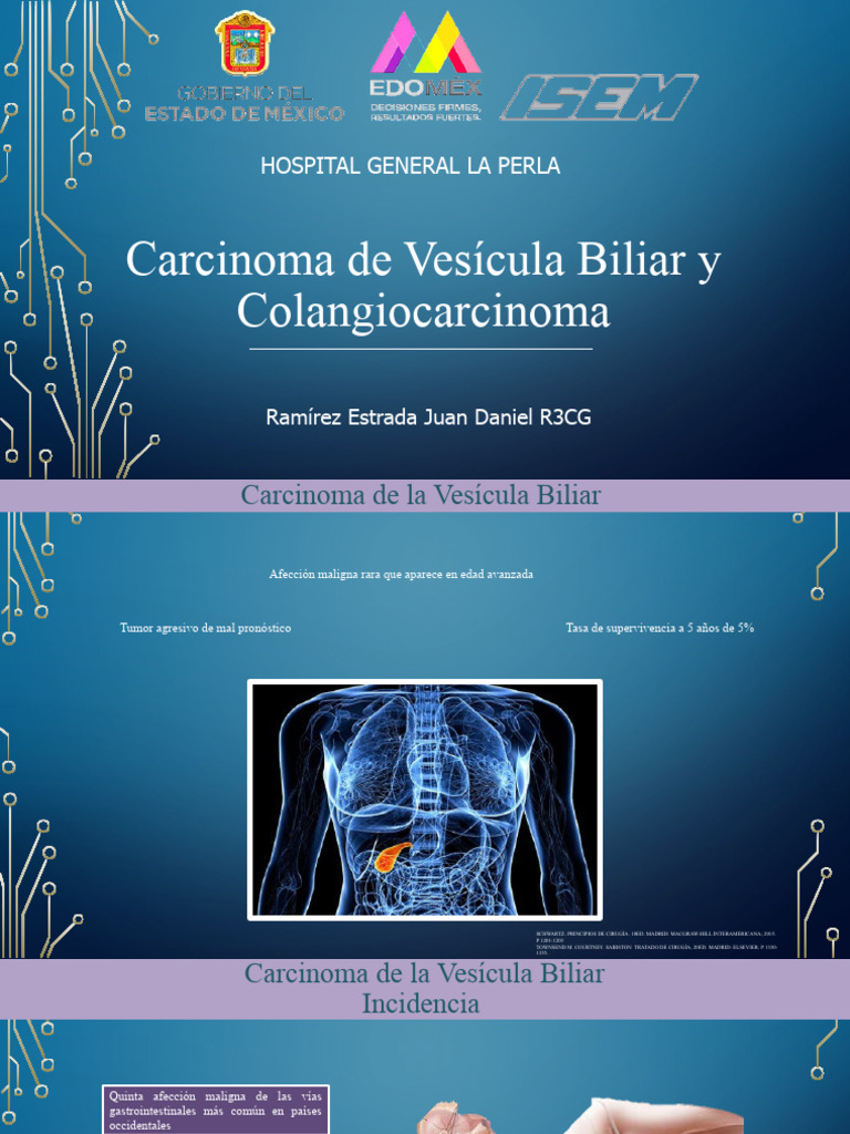 Cancer Vesicular y Colangiocarcinoma | PDF | Metástasis | Neoplasias