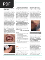 Slit Skin Smear Test Guide | PDF | Leprosy | Cytopathology