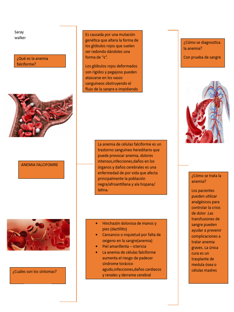 Esquema Anemia Falciforme | PDF | Anemia | Sangre