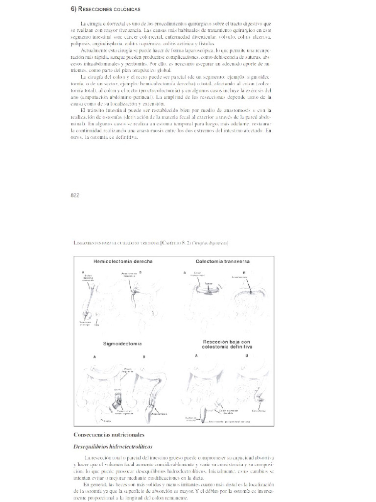 Resecciones colonicas torresani | PDF