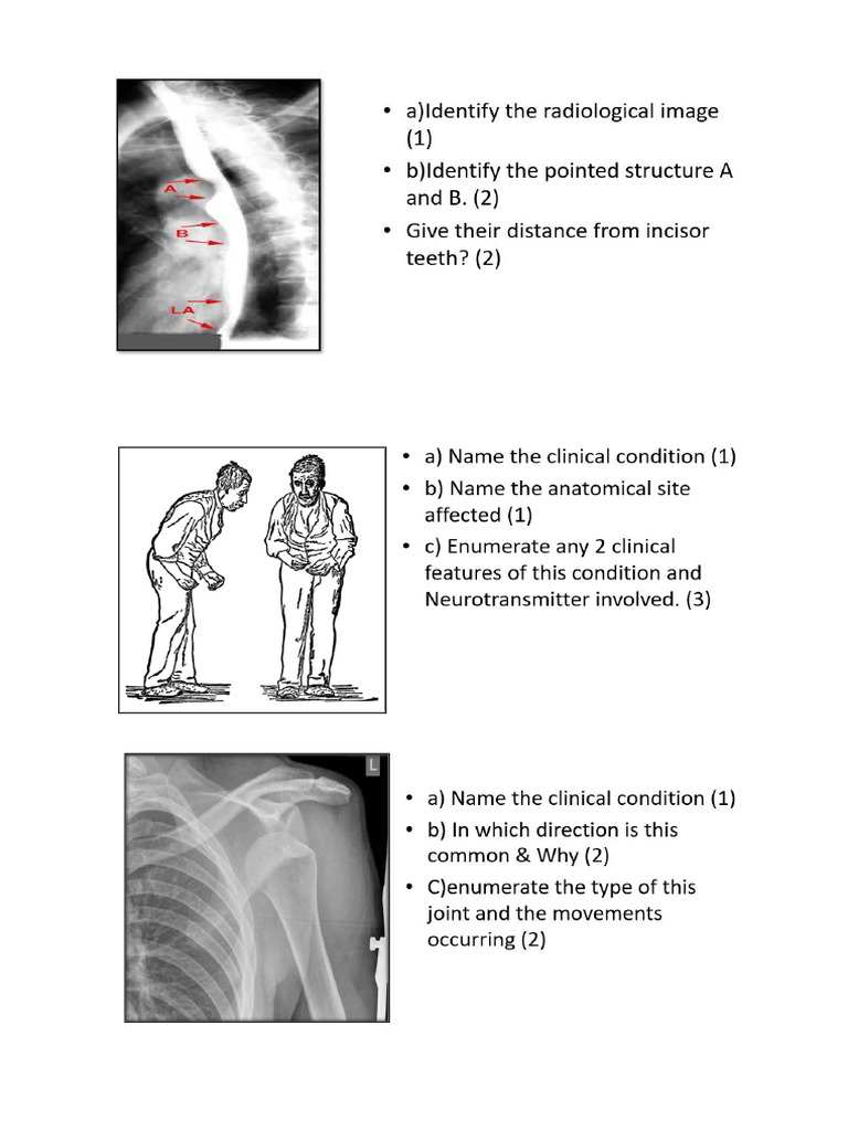 Ospe Questions | PDF