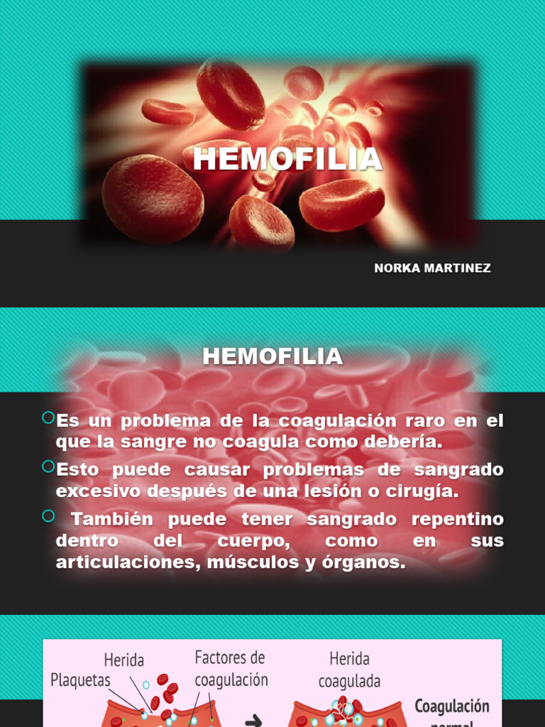 HEMOFILIA | PDF | Hemofilia | Coagulación
