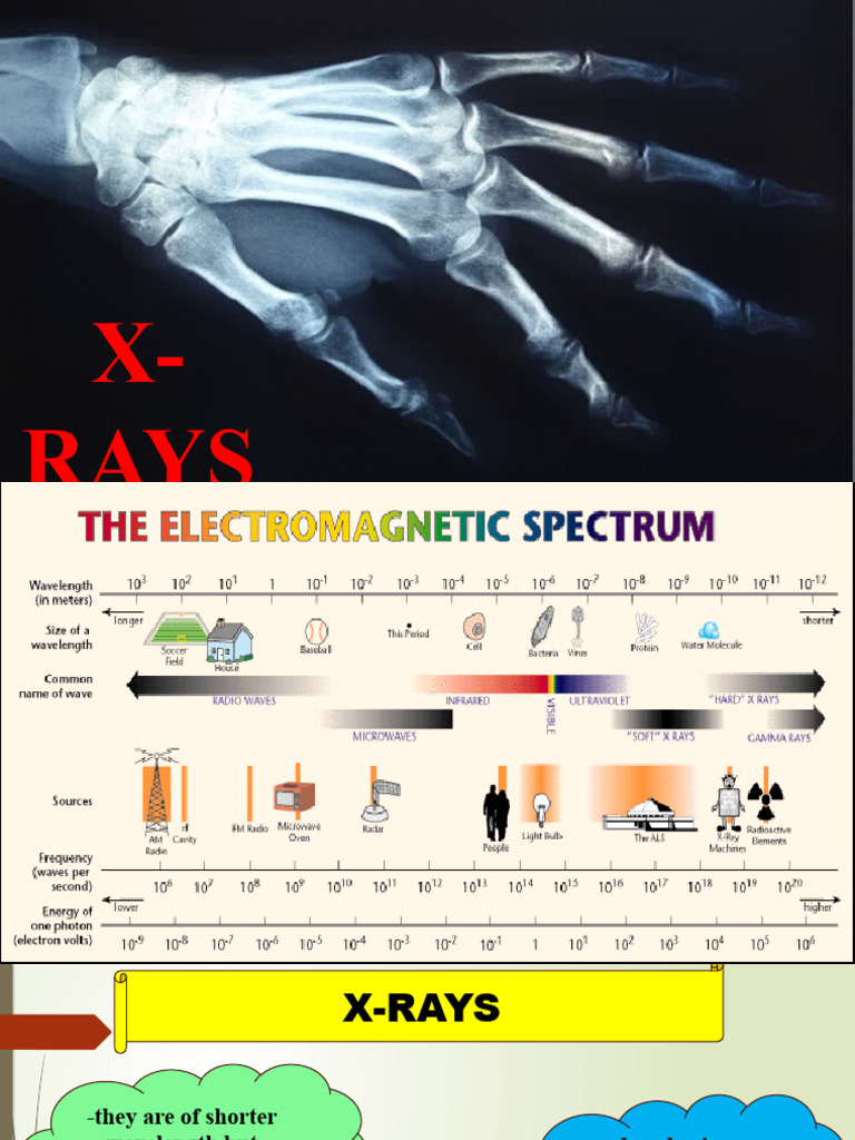 X-Rays and Gamma Rays | PDF | X Ray | Gamma Ray
