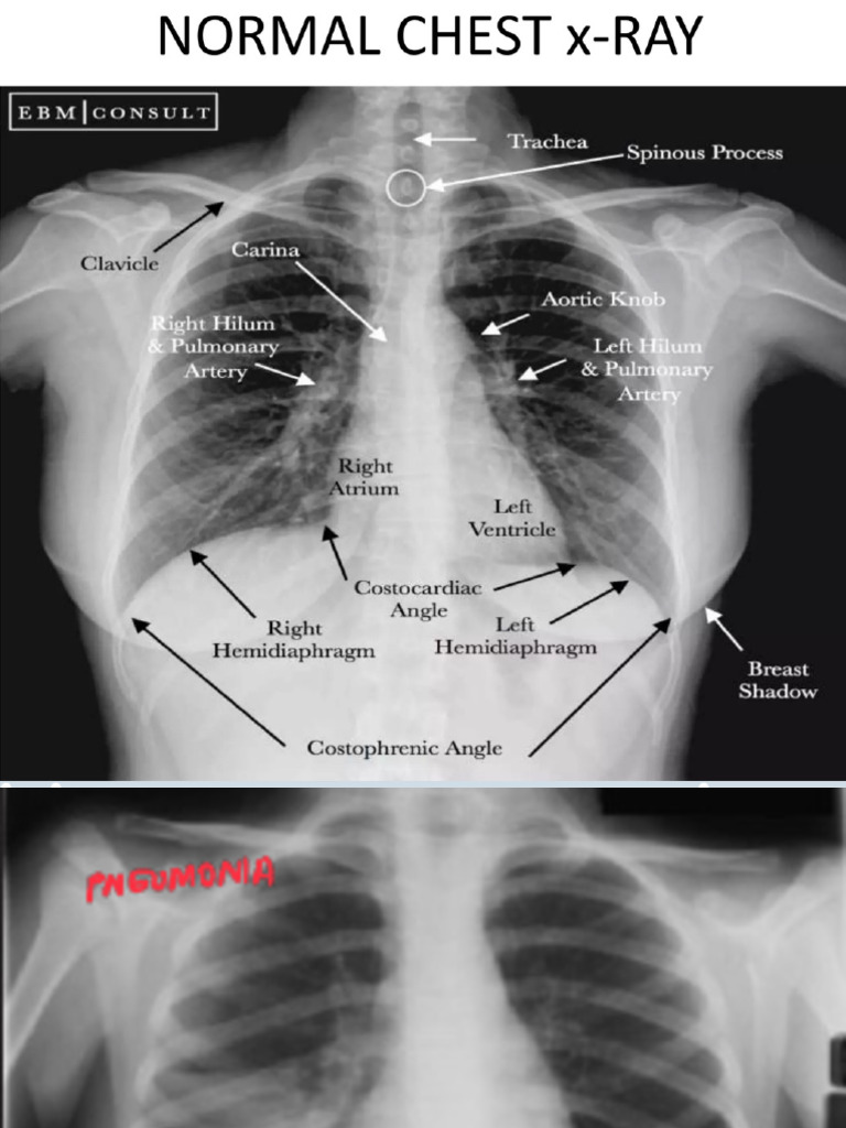 X Rays | PDF