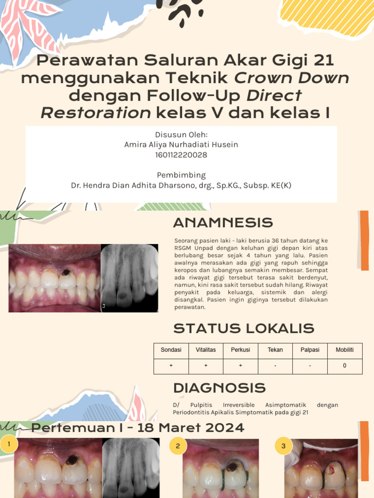Crown Down Direct Restoration: Perawatan Saluran Akar Gigi 21 Menggunakan Teknik Dengan Follow ...