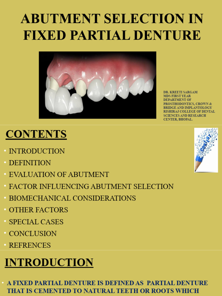 Abutment Selection in FPD DR Kreeti | PDF | Dental Implant | Human Tooth