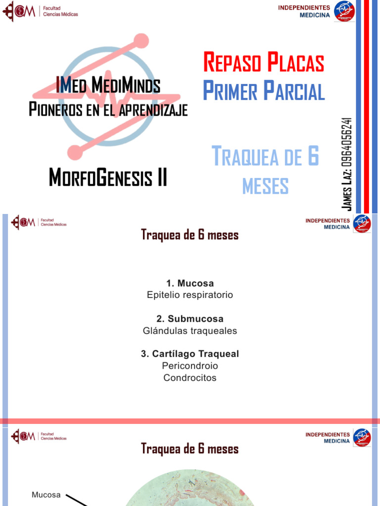 Repaso Placas II 2 | PDF | Laringe | Cartílago