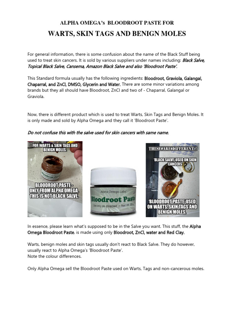 Bloodroot Paste For Warts, Skin Tags and Benign Moles | PDF | Clinical ...