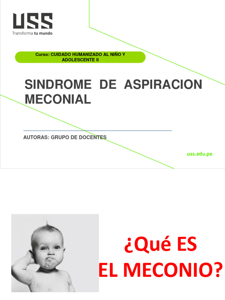 Sindrome de Aspiracion Meconial | PDF Sindrome de Aspiracion Meconial | PDF