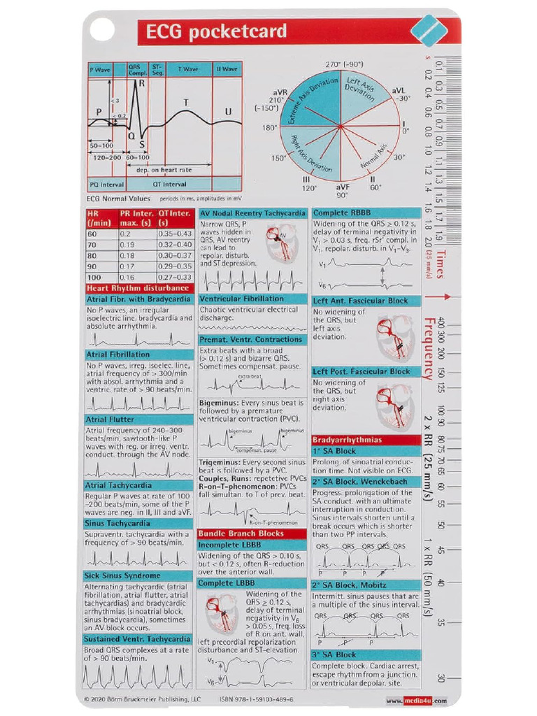 ECG Pocketcard | PDF