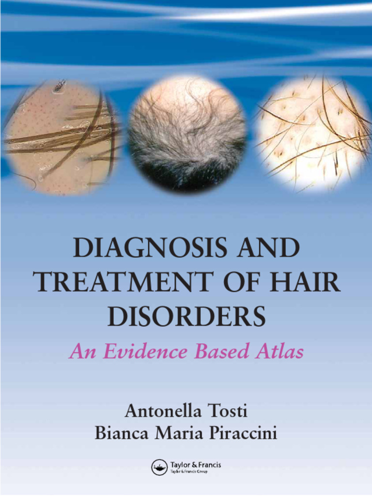 Diagnosis and Treatment of Hair Disorders An Evidence Based Atlas | PDF ...