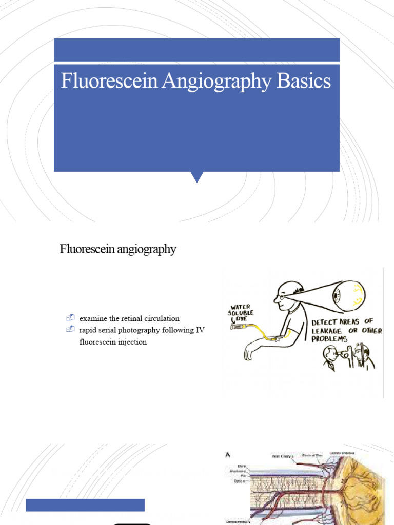 Basic FA | PDF | Angiography | Retina