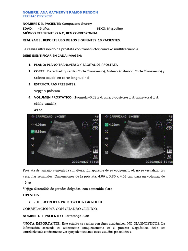 Usg Prostata - Informes Ecograficos - Ana Ramos | PDF | Ultrasonido médico | Próstata