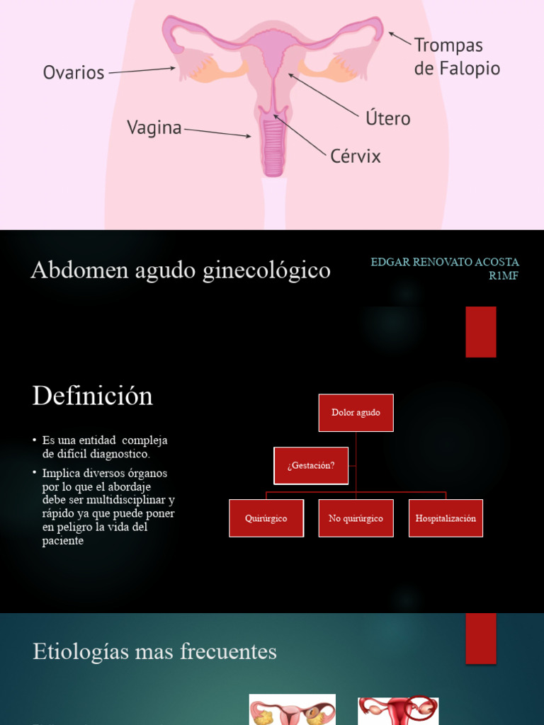 Abdomen Agudo Ginecológico: Diagnóstico y Tratamiento | PDF | El ...