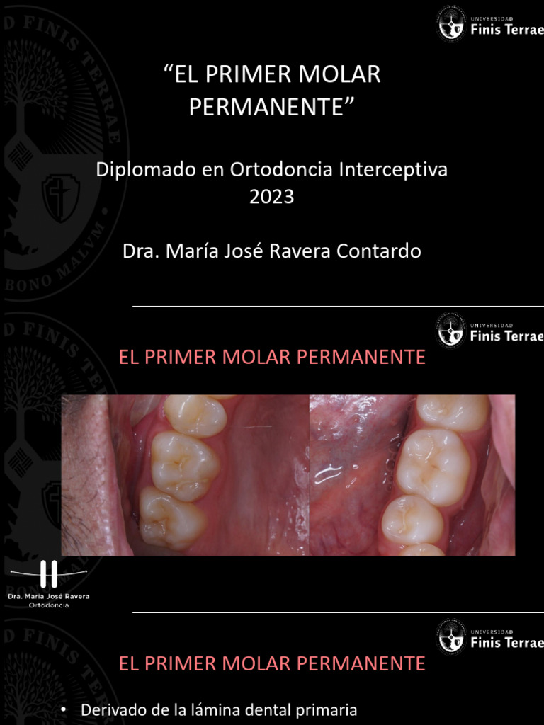 Manejo del Primer Molar Permanente | PDF | Odontología | Diente