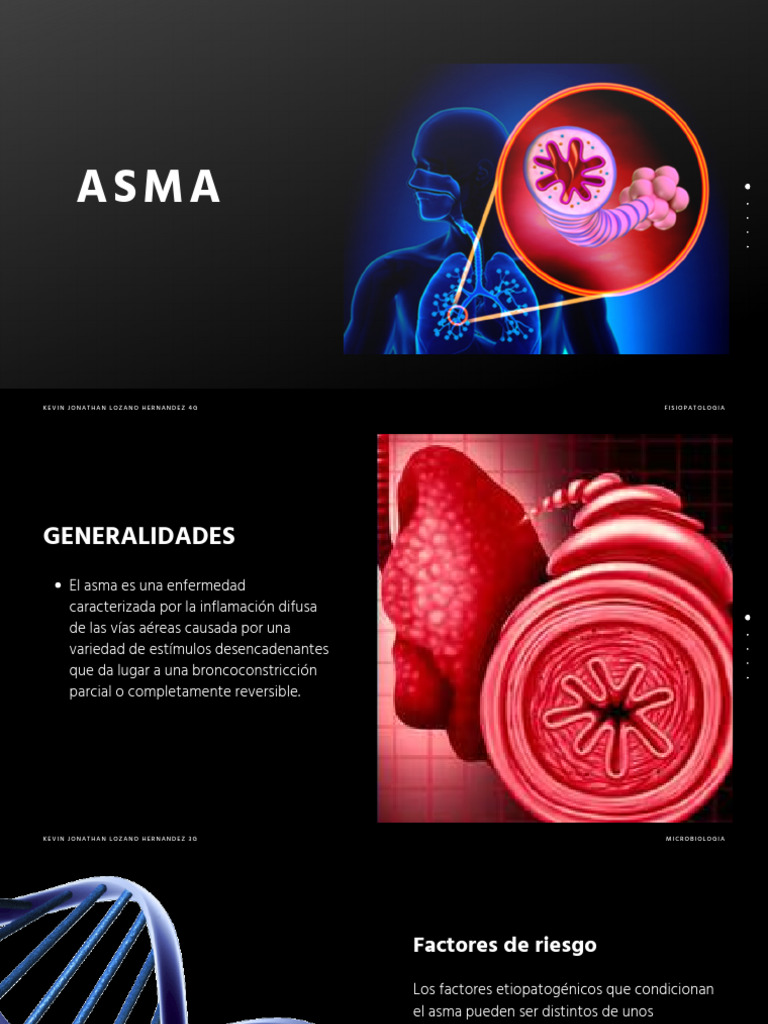 Asma | PDF | Asma | Ciencias de la Salud