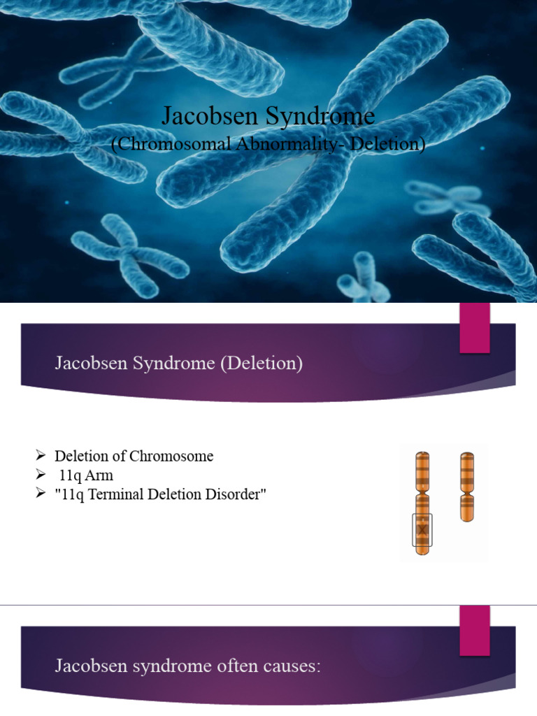 Jacobsen Syndrome 1 | PDF