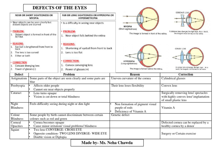 Eye Defects | PDF