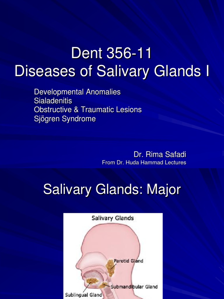 Slide 14 Diseases of Salivary Glands I | Anatomy | Immunology | Free 30 ...