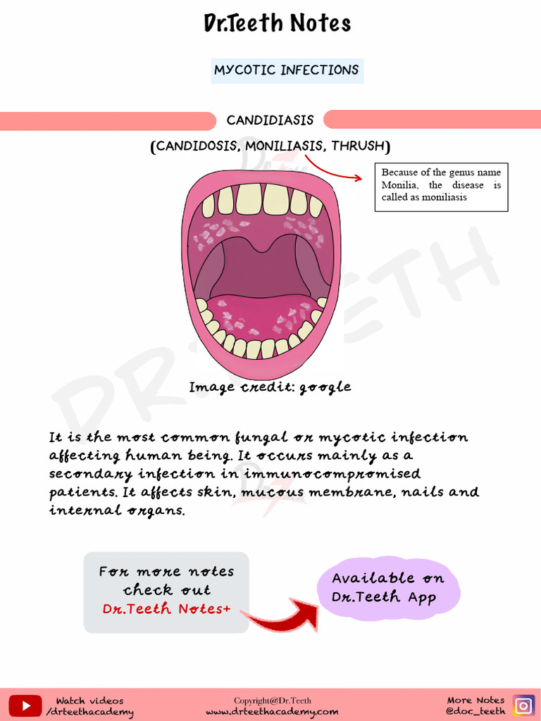 Candidiasis | PDF | Candidiasis | Health Sciences