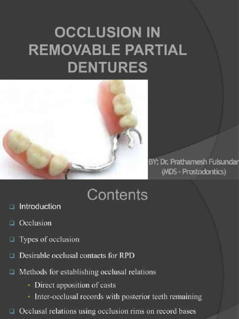 Occlusion in RPD | PDF