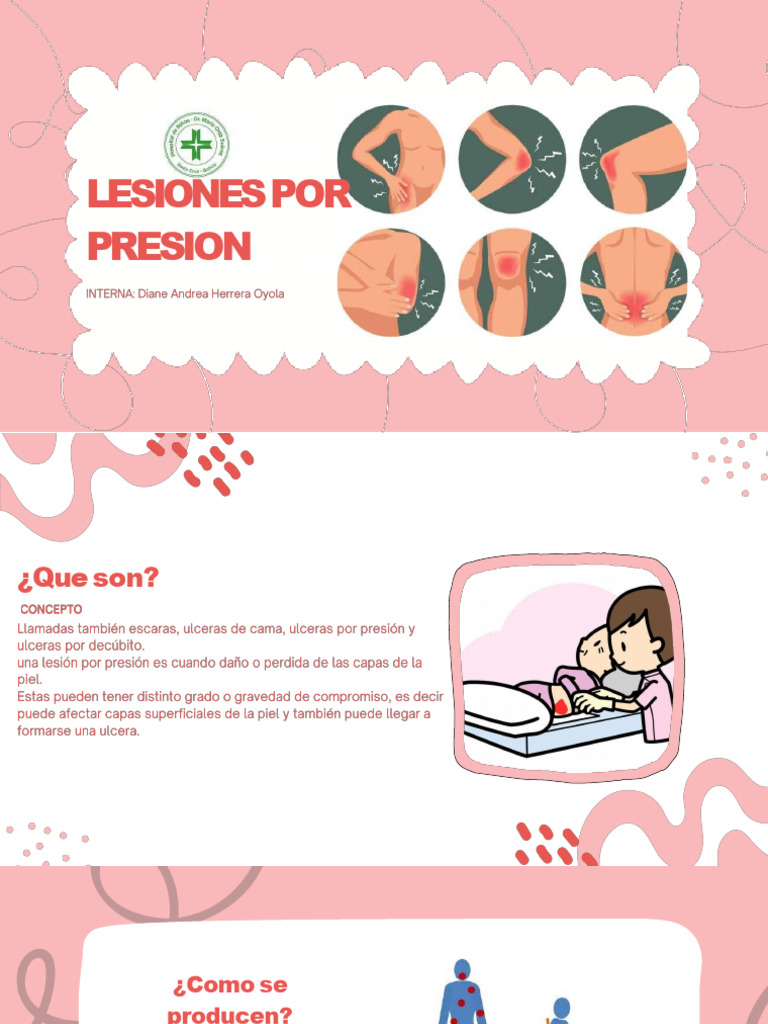 Lesiones Por Presión | PDF