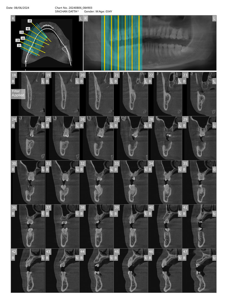 RBD Sinchan Datta | PDF