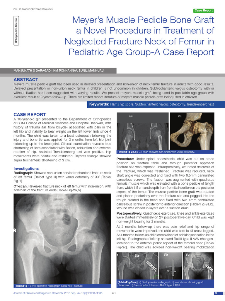 Meyers Muscle Pedicle Bone Graft A Novel Procedur | PDF | Hip ...