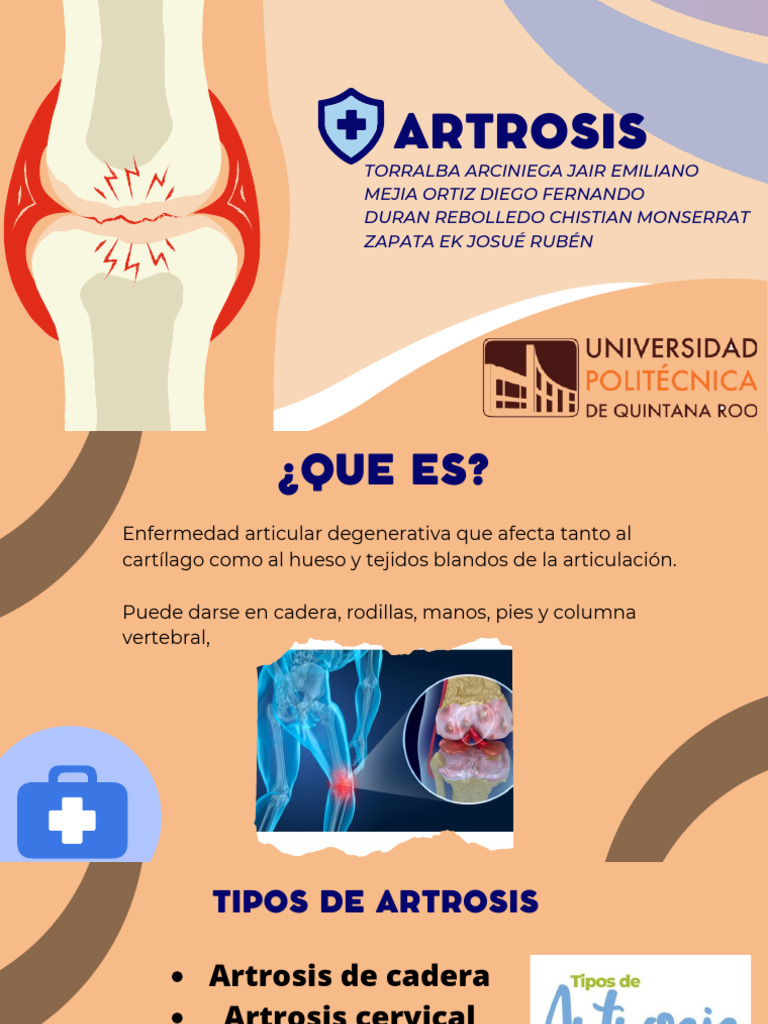 Guía Completa sobre la Artrosis | PDF | Osteoartritis | Articulación