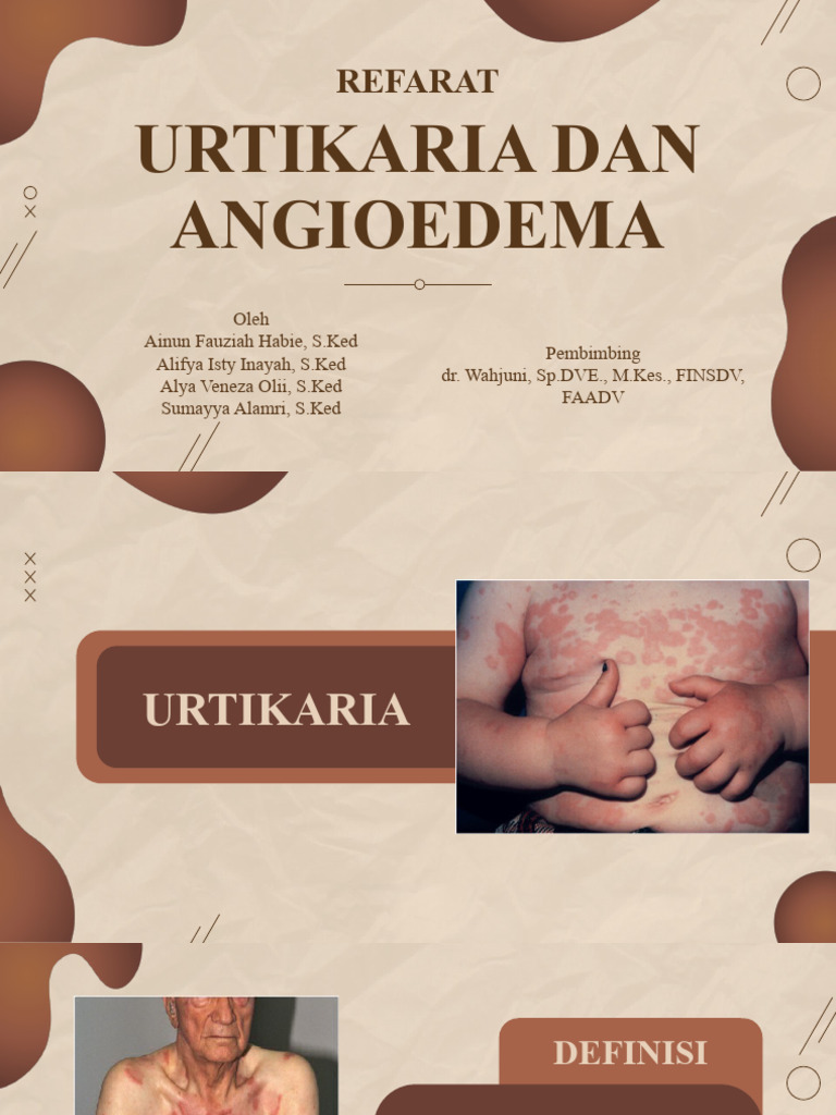 Refarat Urtikaria Dan Angioedema | PDF