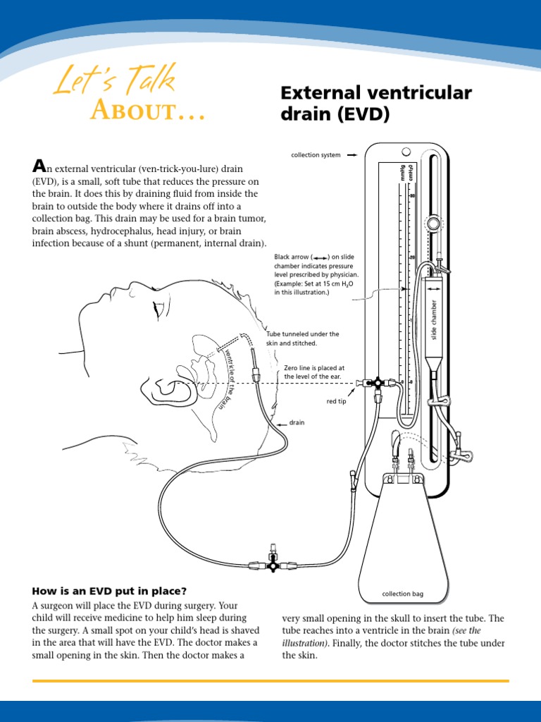 EVD | Physician | Medicine