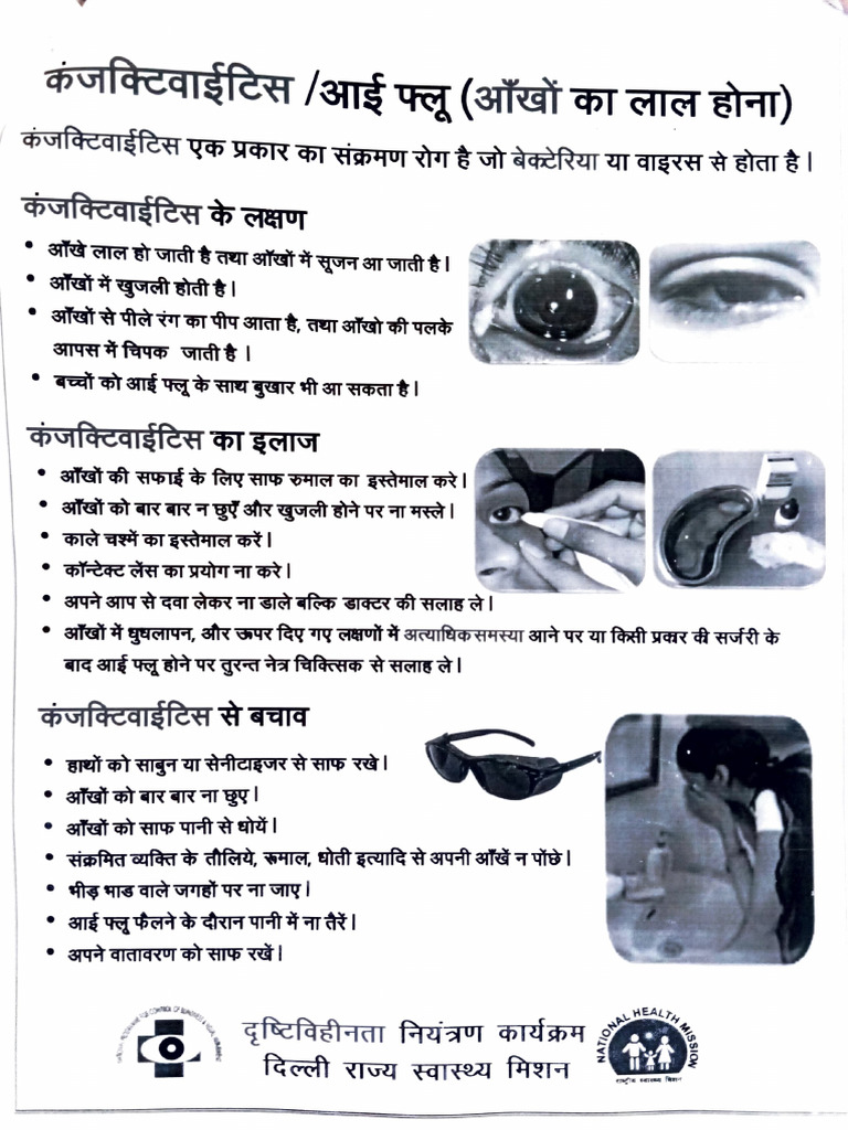 Conjunctivitis-Eye Flu Awareness | PDF | Medical Statistics | Animal ...