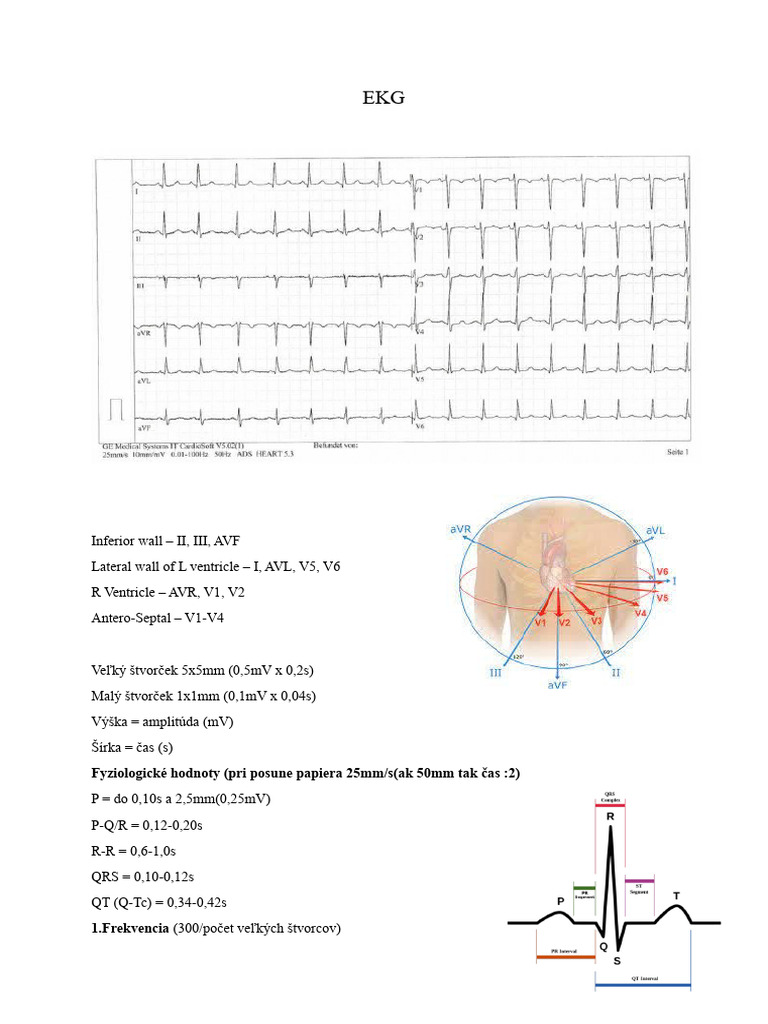 EKG Guideline | PDF