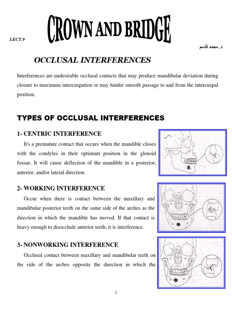 Lec 9 - OCCLUSAL INTERFERENCES | PDF | Tooth | Mouth