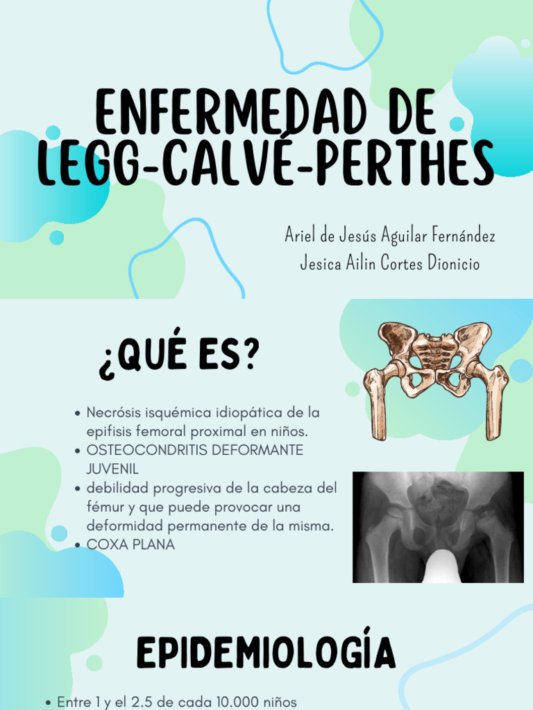 Enfermedad de Legg-Calvé-Perthes | PDF | Medicina CLINICA ...