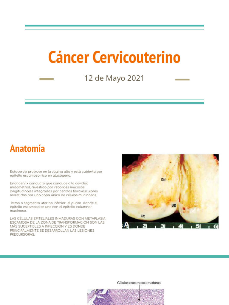 Cáncer Cervicouterino | PDF | Cáncer de cuello uterino | Epitelio
