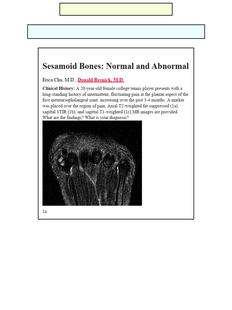 Sesamoid Bones Normal and Abnormal | PDF | Knee | Foot