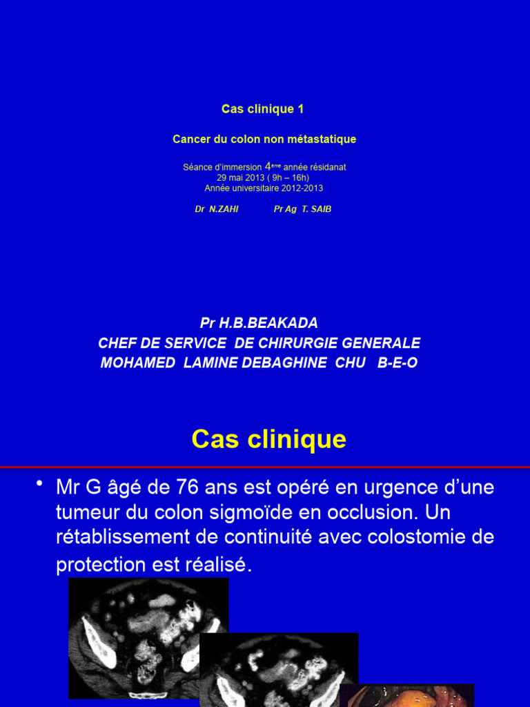 08.cas Clinique Colon Sigmoide | PDF | Cancer du côlon | Médecine clinique