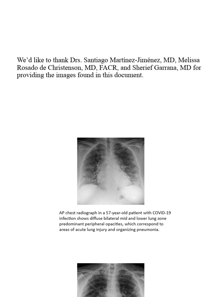 CXR and Chest CT Images 4.9 | PDF | Pneumonia | Medical Specialties