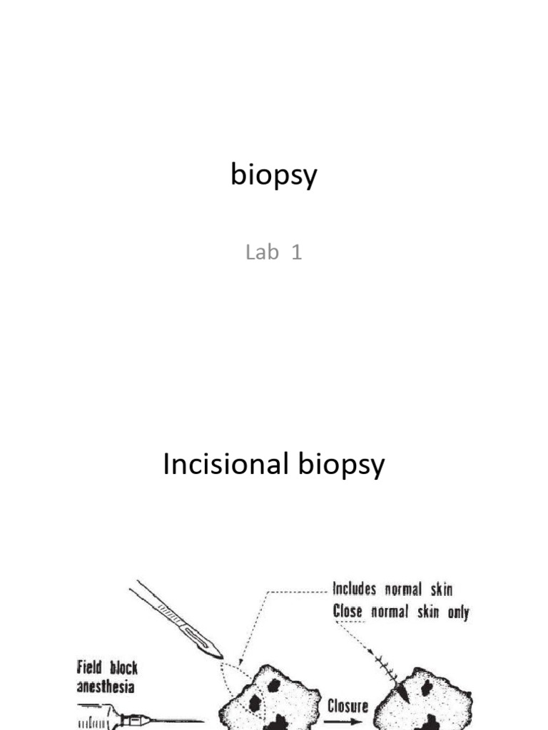 Biopsy Lab 1 2 | PDF | Pathology | Biopsy