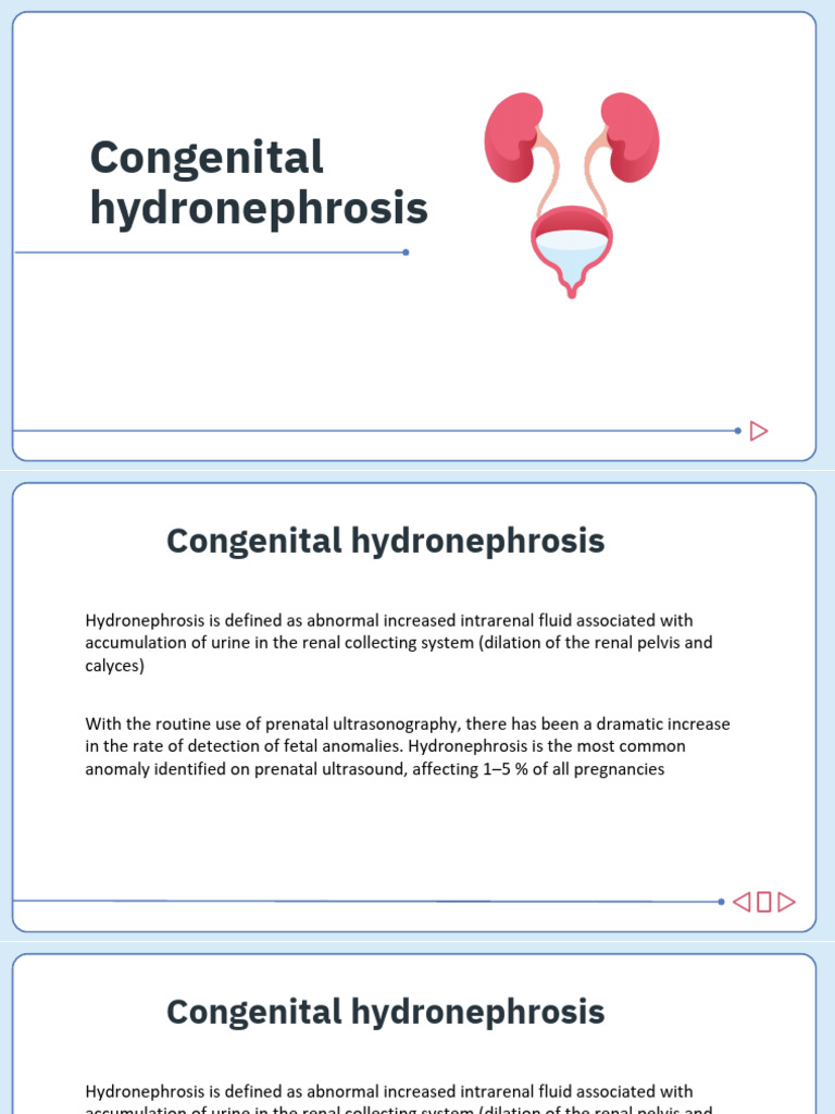 Congenital Hydronephrosis | PDF