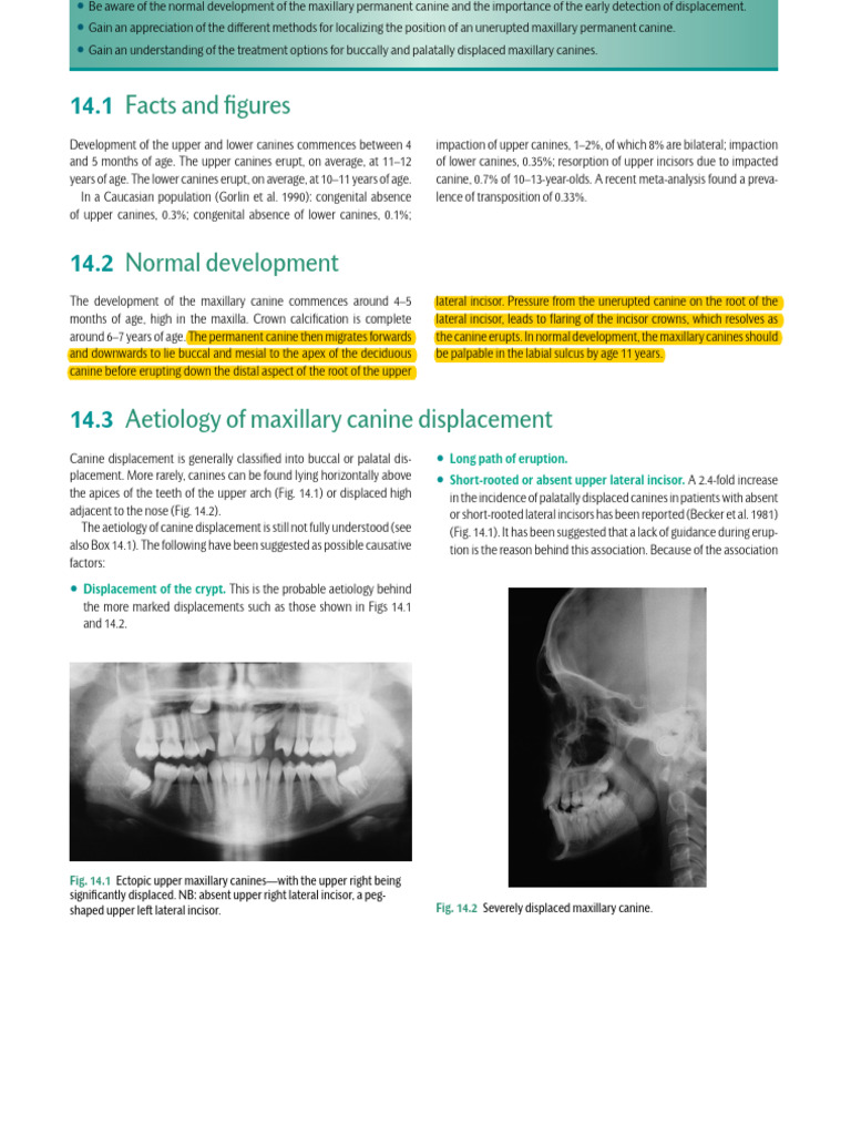 Maxillary Permanent Canines | PDF | Orthodontics | Human Tooth