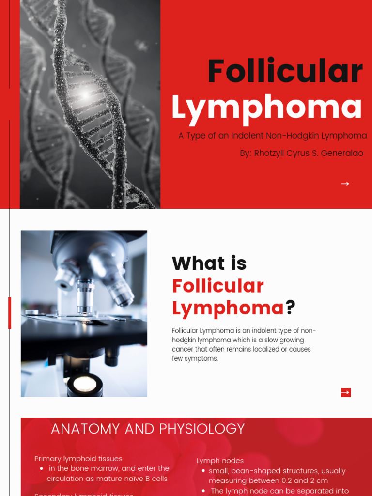 GENERALAO - Follicular Lymphoma - PPT | PDF | Lymph Node | Lymphatic System