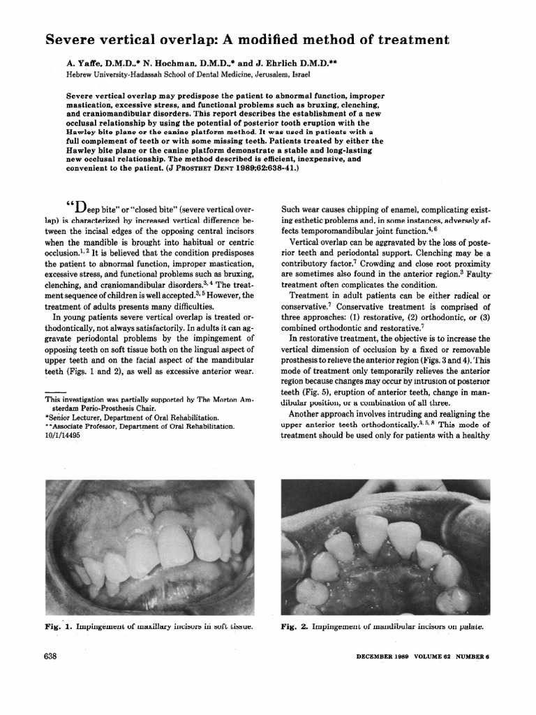 JPD 1989 Severe vertical overlap A modified method of treatment拷貝 | PDF ...