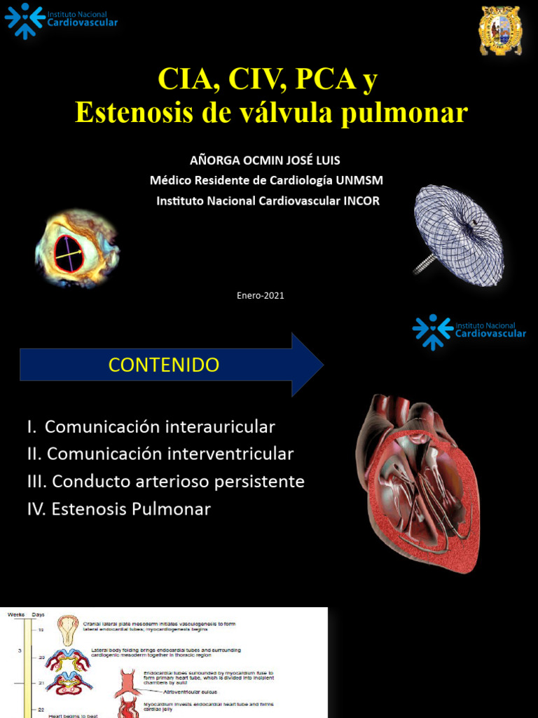 Cia, Civ, Pca, Estenosis Pulmonar Jose Luis Añorga | PDF | Electrocardiografia | Ventrículo ...