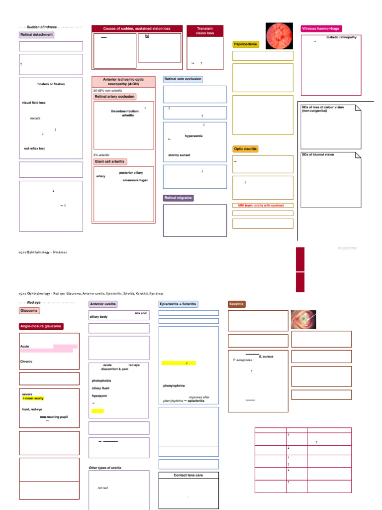05 Ophthal - Drawio | PDF | Glaucoma | Human Eye